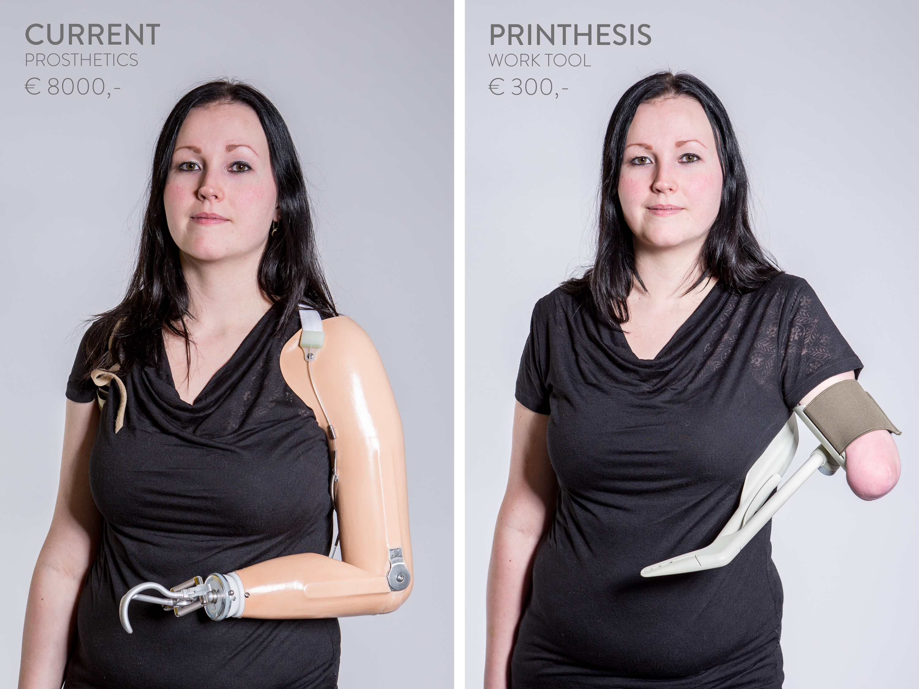The Printhesis - cheap, lightweight and comfortable 3D-printed ...