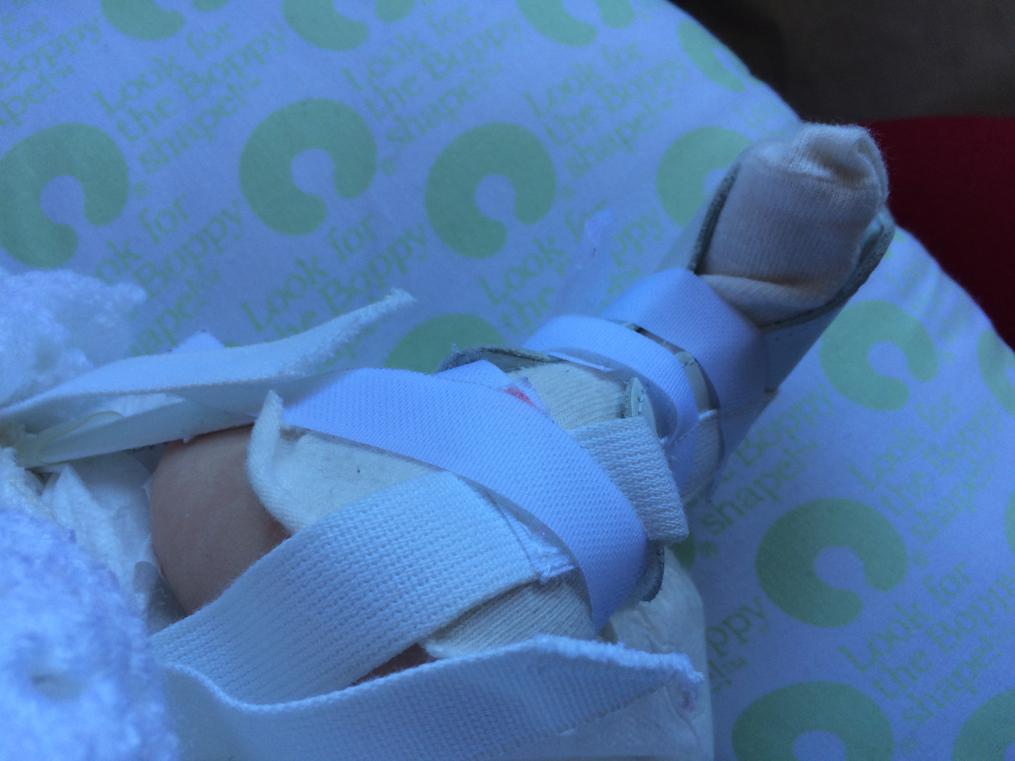 Pavlik become a more comfortable | Patient Innovation