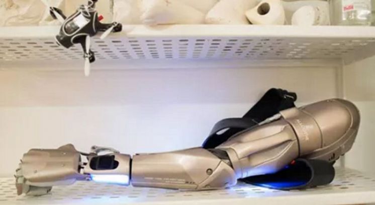 Advanced prosthetic arm | Patient Innovation