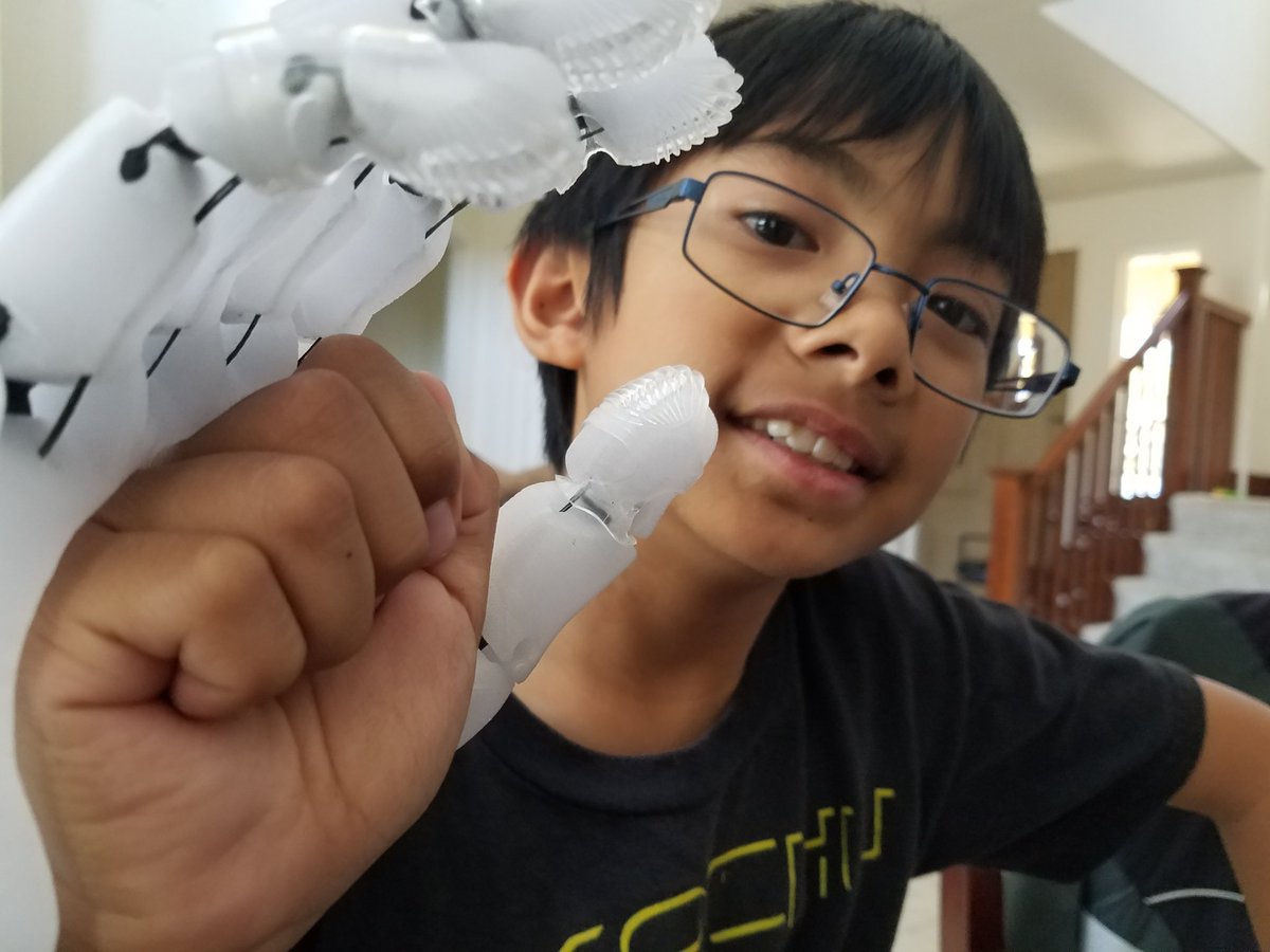 Boy creates 3D printed mechanical hand for a teacher | Patient Innovation