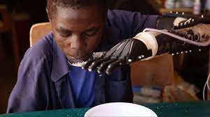 Project Daniel, a Collaborative open source 3D Prosthesis project led ...