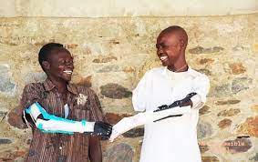 Project Daniel, a Collaborative open source 3D Prosthesis project led ...