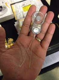 Professor Graeme Clark invented the Cochlear Implant | Patient Innovation