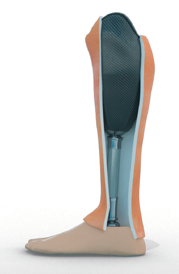 Amputee develops cover for prosthetics | Patient Innovation