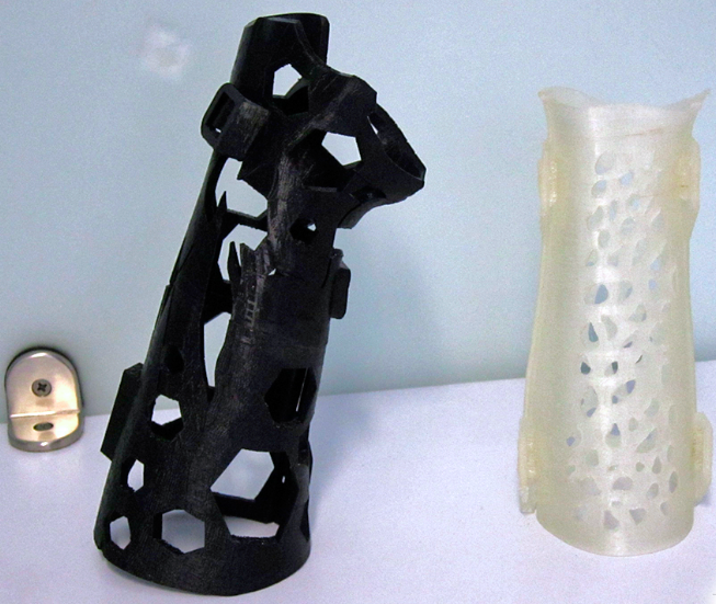 Man invents 3D printed cast for his mother | Patient Innovation