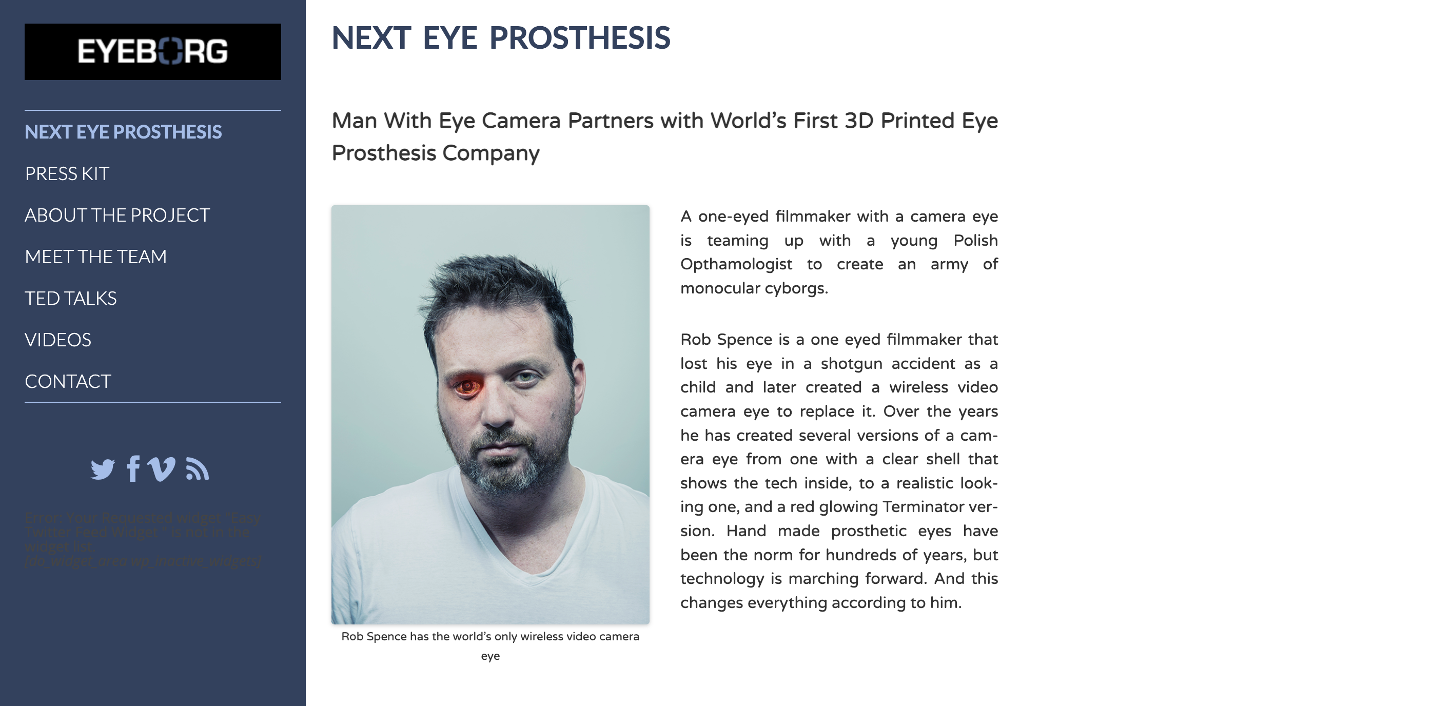 Rob Spence, a filmmaker, lost his eye and created the Eyeborg Project ...