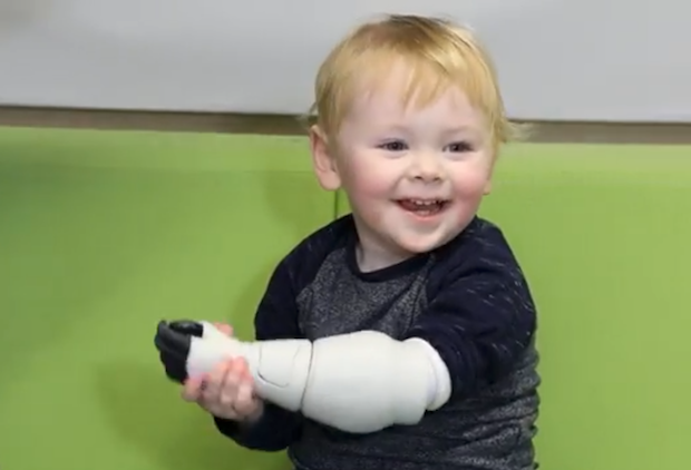 Father creates a bionic limb for his baby son using Xbox scanner and 3D ...